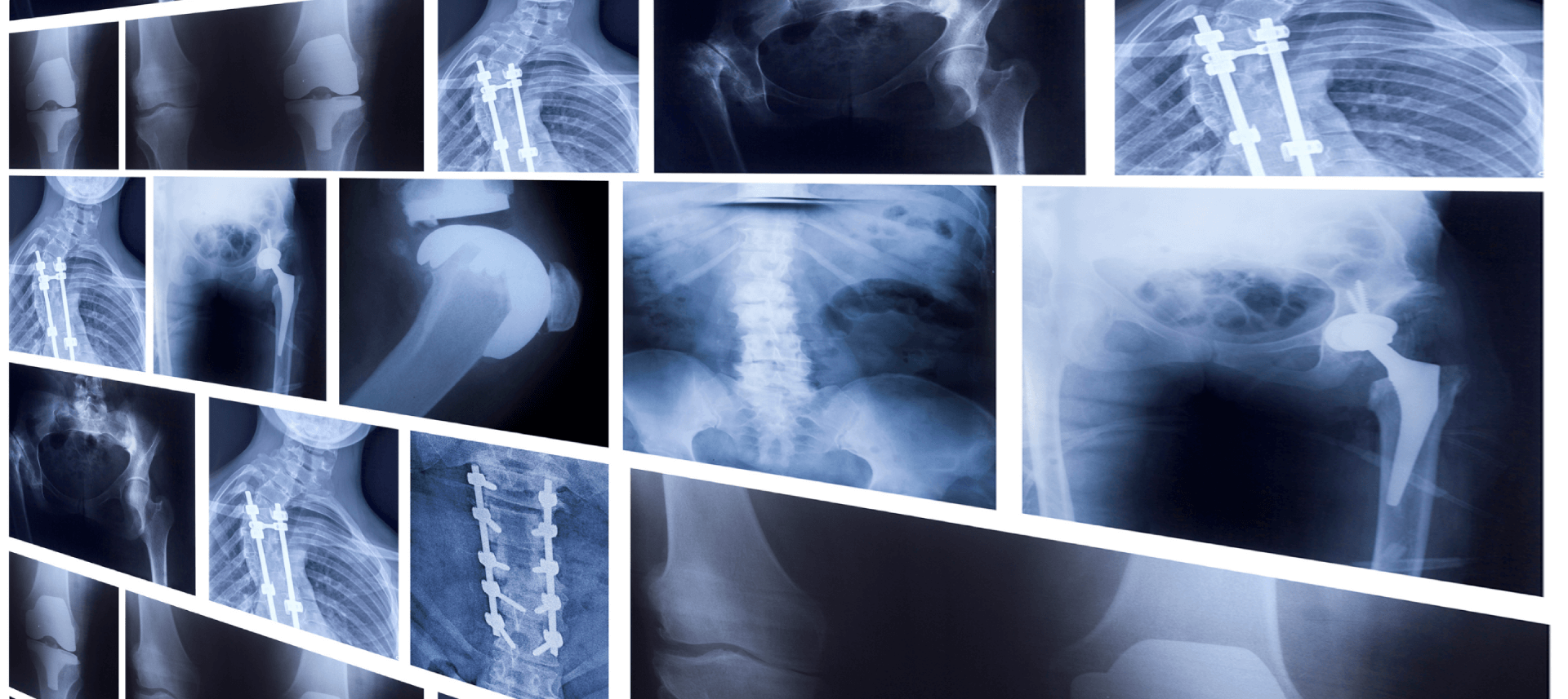 What Is the Difference Between Radiography and Radiology?